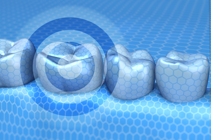 Is Silver Diamine Fluoride the Key to Preventing Caries in Under-served ...