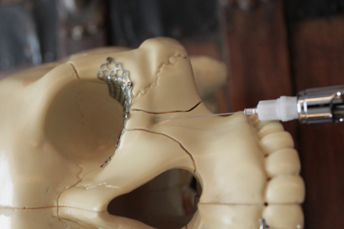 IO-My! Getting the Perfect Anesthesia Injection - Today's RDH