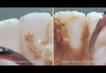 The Oral Bacteria Prevotella intermedia and its Link to Gout and ...