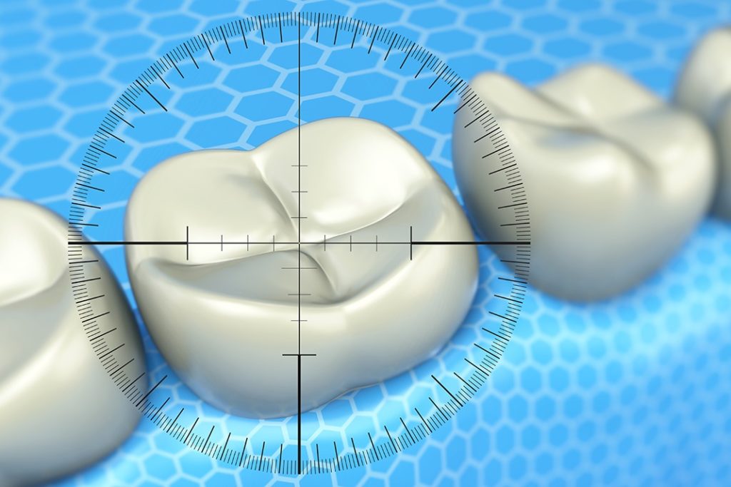Topical vs. Systemic Fluoride: What Patients Need to Know - Today's RDH
