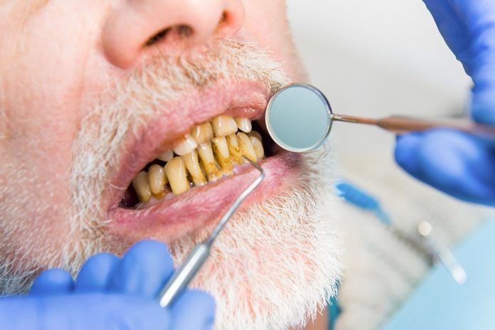 Geriatric Care: Oral Hygiene Challenges in Care Facilities - Today's RDH