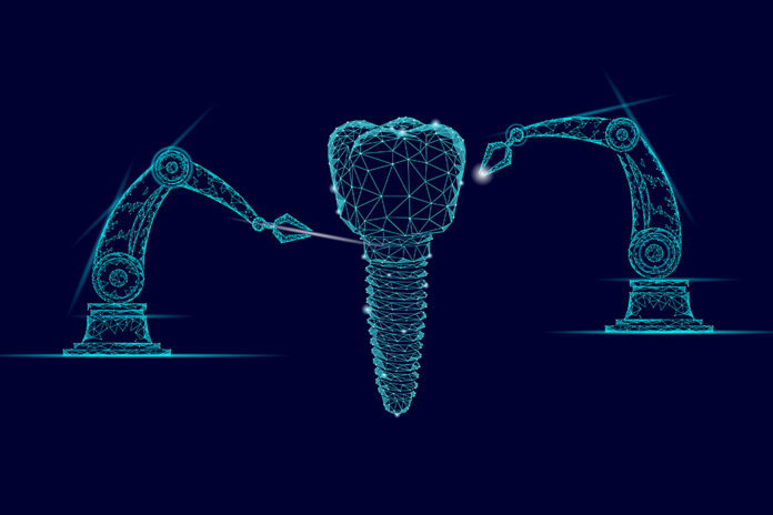 Researchers Build a Smart Dental Implant that Resists Bacterial Growth ...